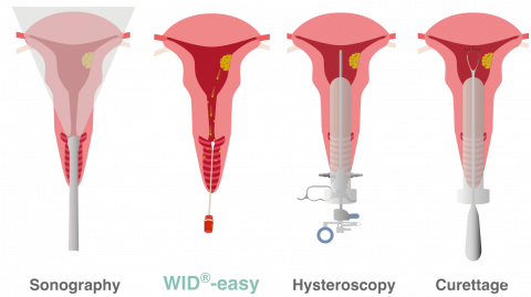 WID®-easy information for patients